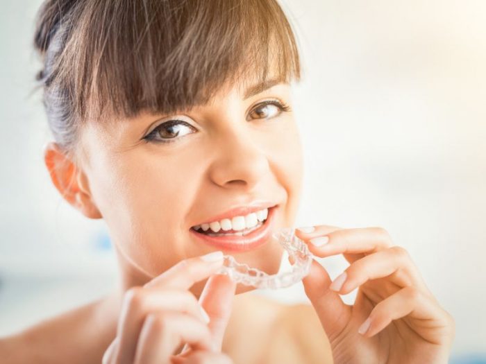 Sistemas Ertty na Ortodontia: O que São e Como Funcionam ⋆ Ateliê Oral